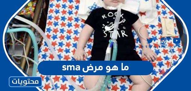 ما هو مرض sma ؟ وما هي أنواعه وأعراضه وكيفية علاجه - موقع محتويات